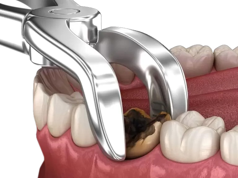 Why Do My Teeth Hurt? Let's Find Out! | Smiles Dental Group