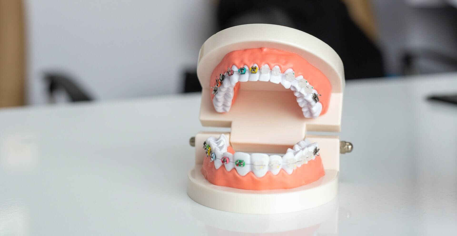 Buck Teeth (Overbite) - What You Need To Know | Dentists In Edmonton ...